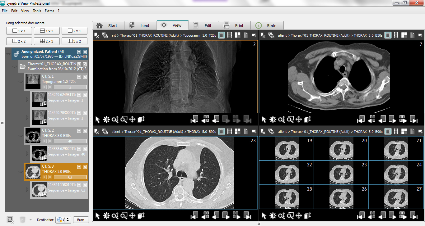 Synedra View – DICOM Viewer - PAPAPOSTOLOU