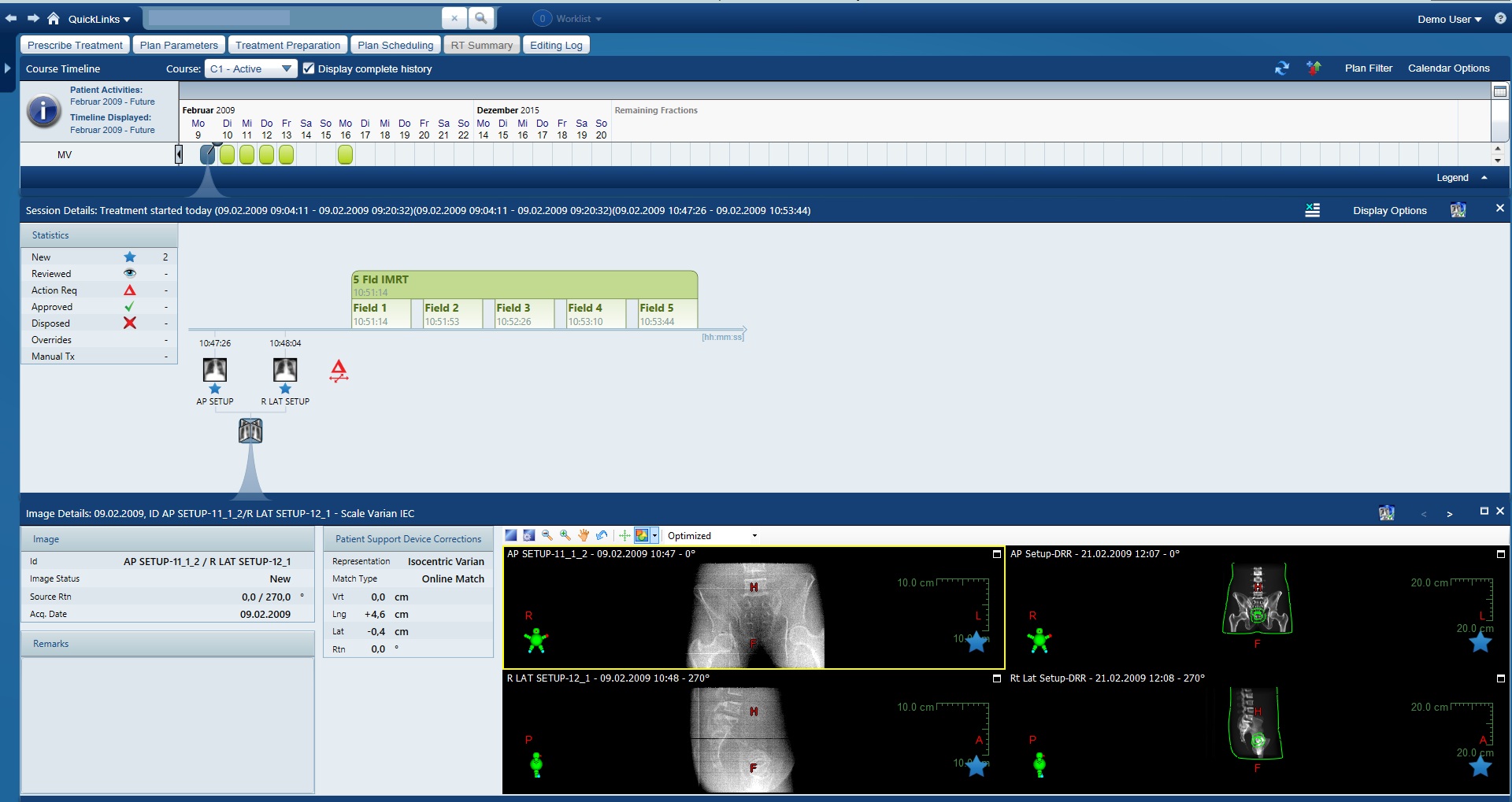 ARIA® OIS FOR RADIATION ONCOLOGY - PAPAPOSTOLOU