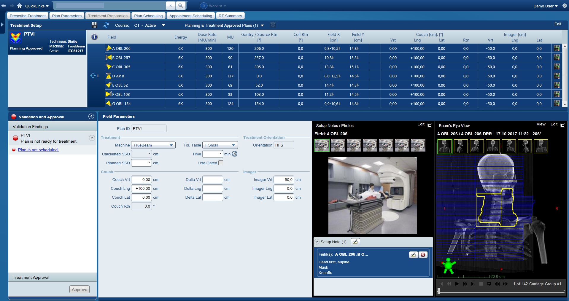 ARIA® OIS FOR RADIATION ONCOLOGY - PAPAPOSTOLOU