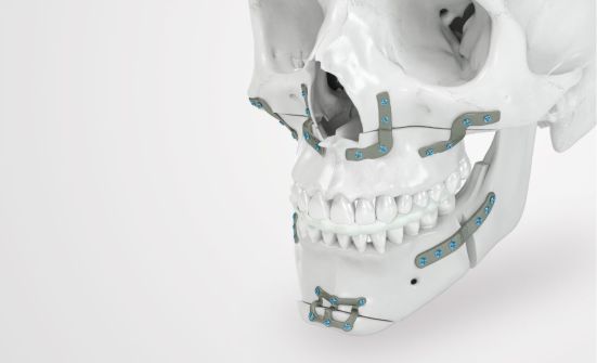 IPS IMPLANTS - PAPAPOSTOLOU