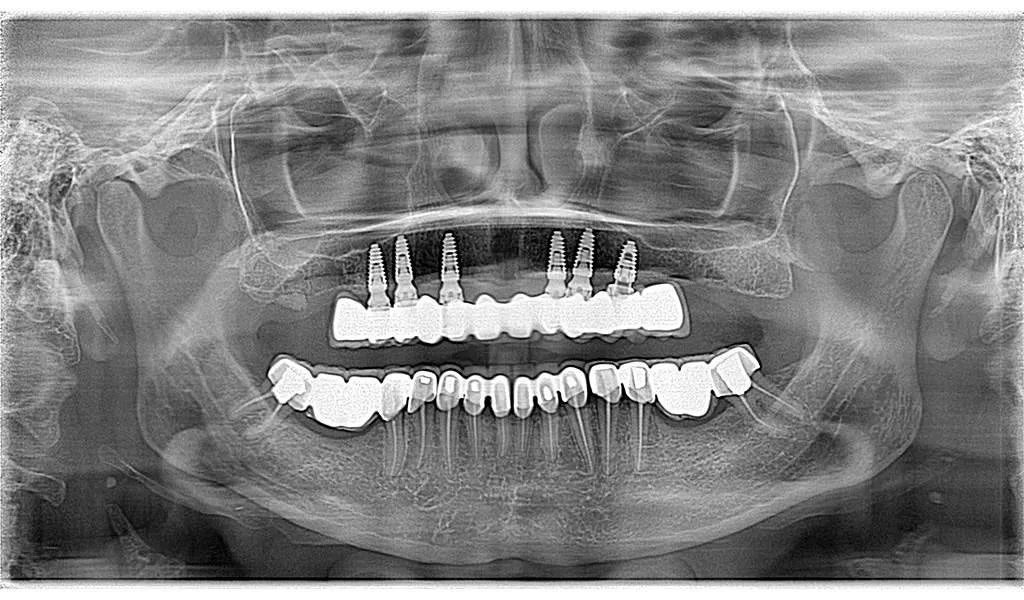 I-MAX CEPH - PAPAPOSTOLOU