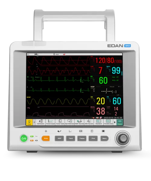 Compact μόνιτορ σύγχρονης τεχνολογίας, iM60 - ΠΑΠΑΠΟΣΤΟΛΟΥ
