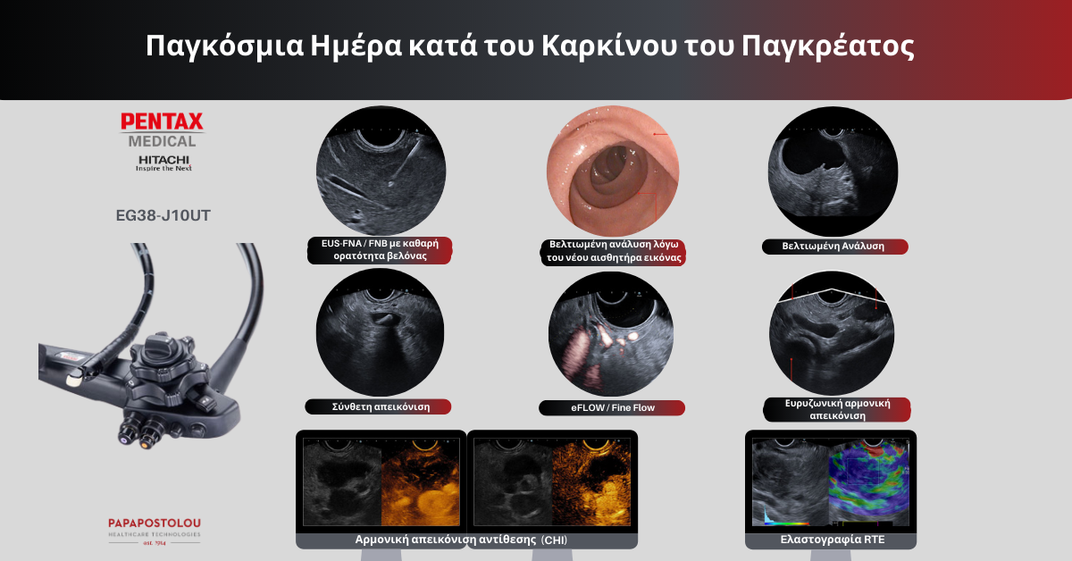 Παγκόσμια Ημέρα κατά του Καρκίνου του Παγκρέατος - ΠΑΠΑΠΟΣΤΟΛΟΥ