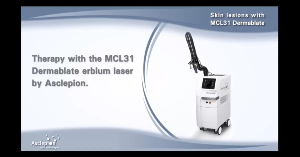 uMR OMEGA™ | 75-cm Ultra-Wide-Bore 3.0T - ΠΑΠΑΠΟΣΤΟΛΟΥ