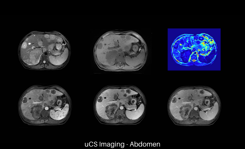 uMR 770 / 780 | 65cm Wide-Bore 3.0T MR - ΠΑΠΑΠΟΣΤΟΛΟΥ