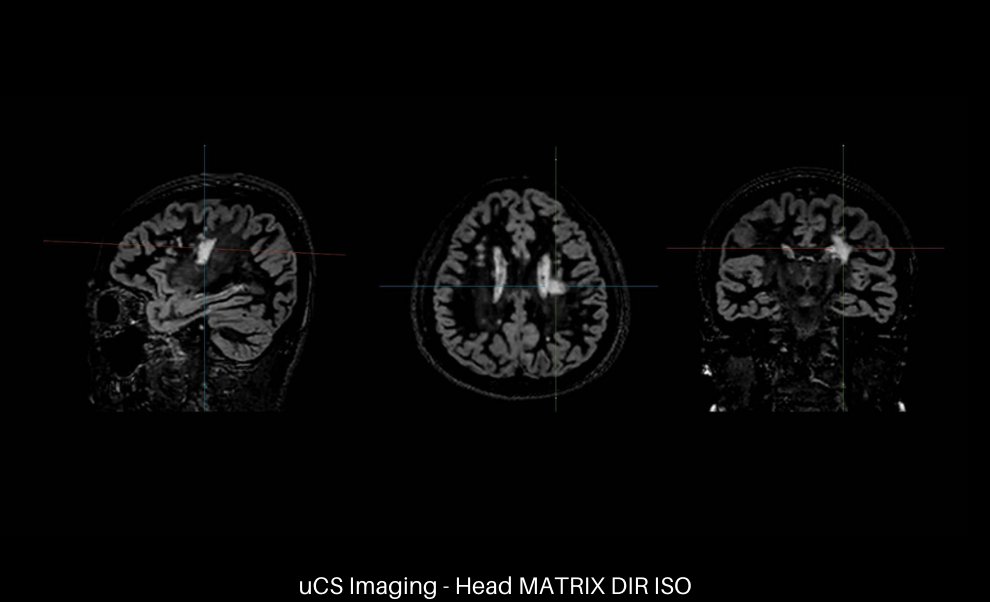 uMR 770 / 780 | 65cm Wide-Bore 3.0T MR - ΠΑΠΑΠΟΣΤΟΛΟΥ