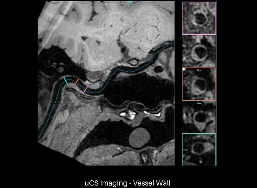 uMR 770 / 780 | 65cm Wide-Bore 3.0T MR - ΠΑΠΑΠΟΣΤΟΛΟΥ