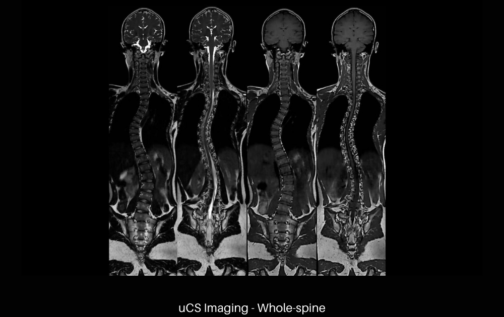 uMR 770 / 780 | 65cm Wide-Bore 3.0T MR - ΠΑΠΑΠΟΣΤΟΛΟΥ