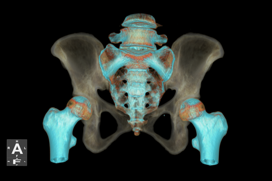 uCT 528 40 / 80 slice - ΠΑΠΑΠΟΣΤΟΛΟΥ