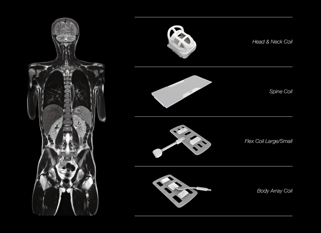 uMR 580 | Full-Digital 1.5T MR - ΠΑΠΑΠΟΣΤΟΛΟΥ