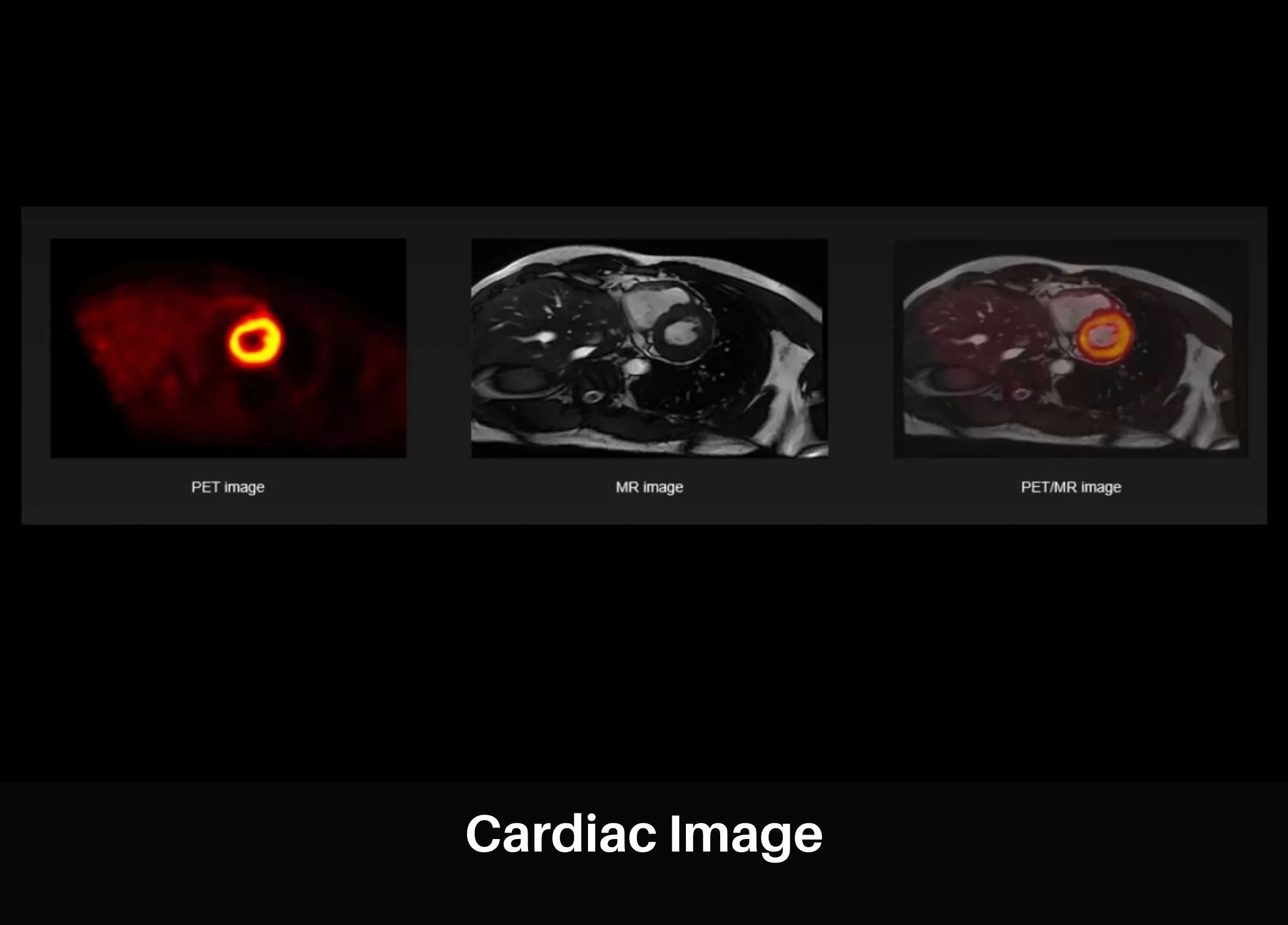 uPMR 790 | HD TOF PET/MR - ΠΑΠΑΠΟΣΤΟΛΟΥ