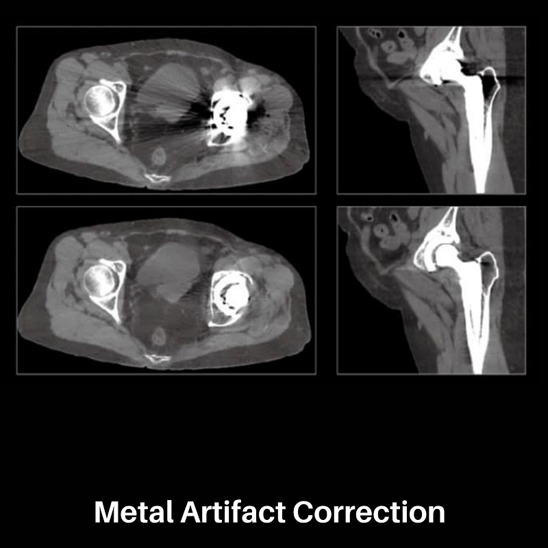 uMI 550 | Digital High-Resolution PET/CT - ΠΑΠΑΠΟΣΤΟΛΟΥ