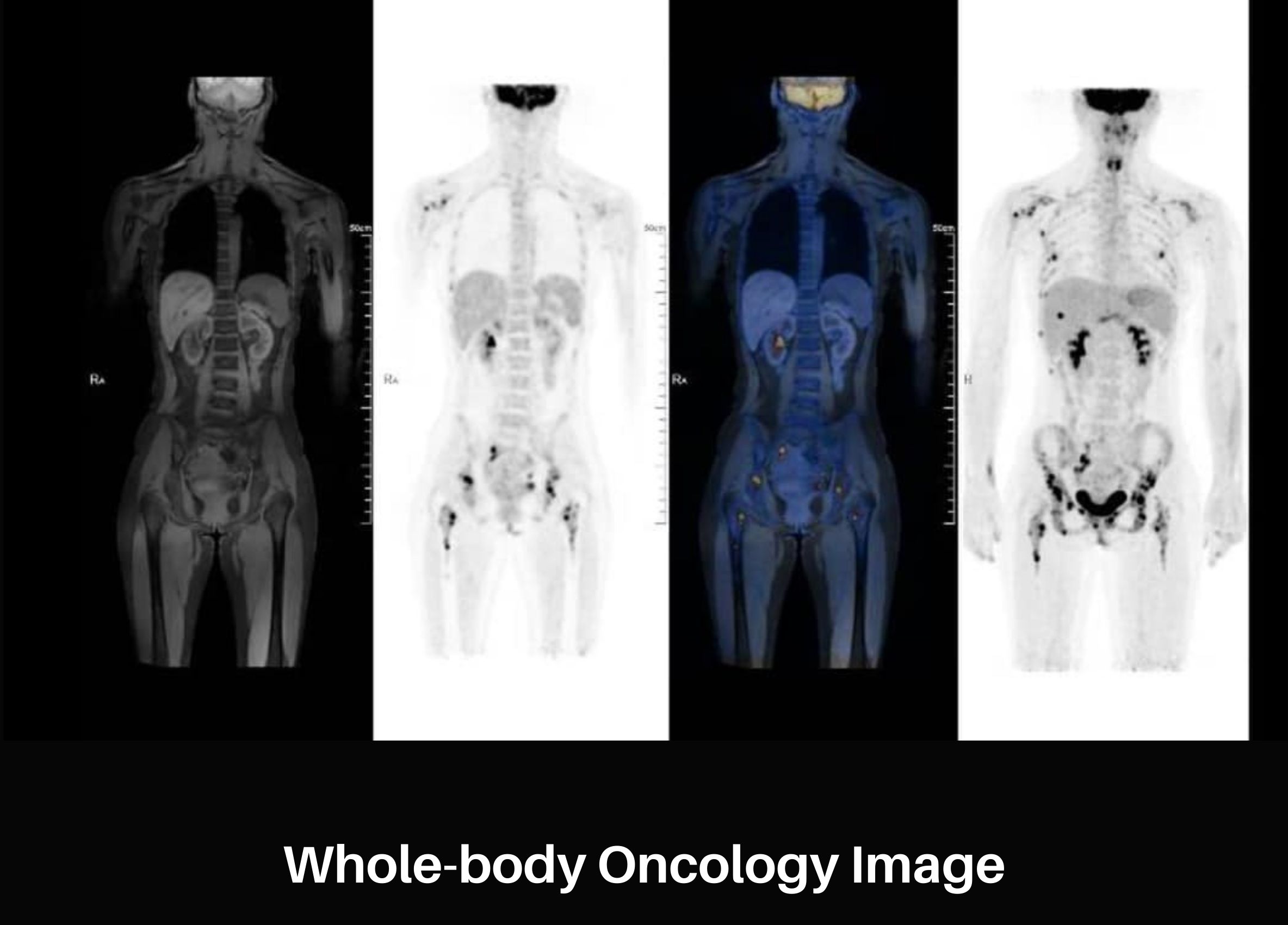 uPMR 790 | HD TOF PET/MR - ΠΑΠΑΠΟΣΤΟΛΟΥ