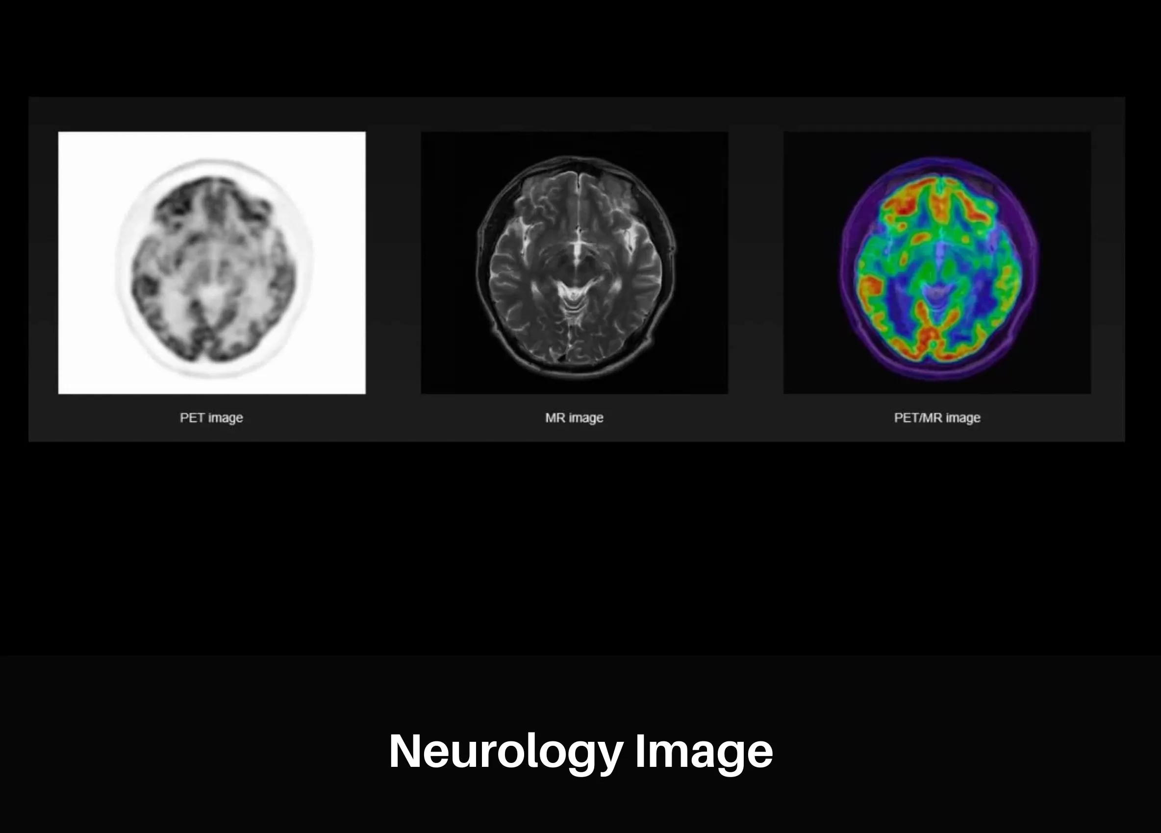 uPMR 790 | HD TOF PET/MR - ΠΑΠΑΠΟΣΤΟΛΟΥ