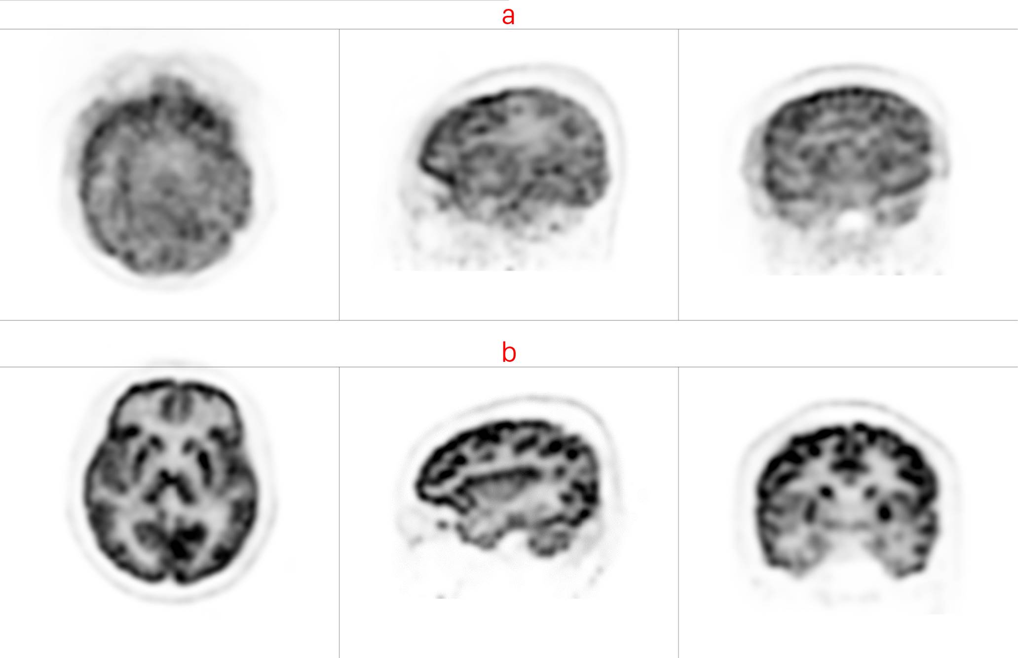 uMI 780 | Ultra-Fast High-Resolution Digital PET/CT - ΠΑΠΑΠΟΣΤΟΛΟΥ