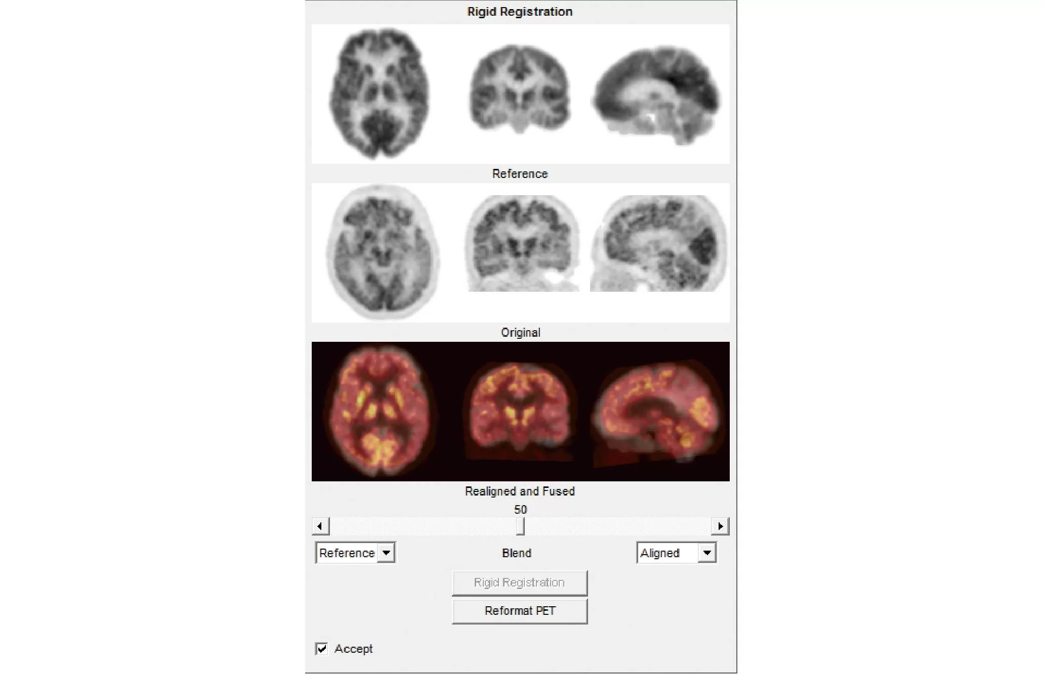 uMI 780 | Ultra-Fast High-Resolution Digital PET/CT - ΠΑΠΑΠΟΣΤΟΛΟΥ
