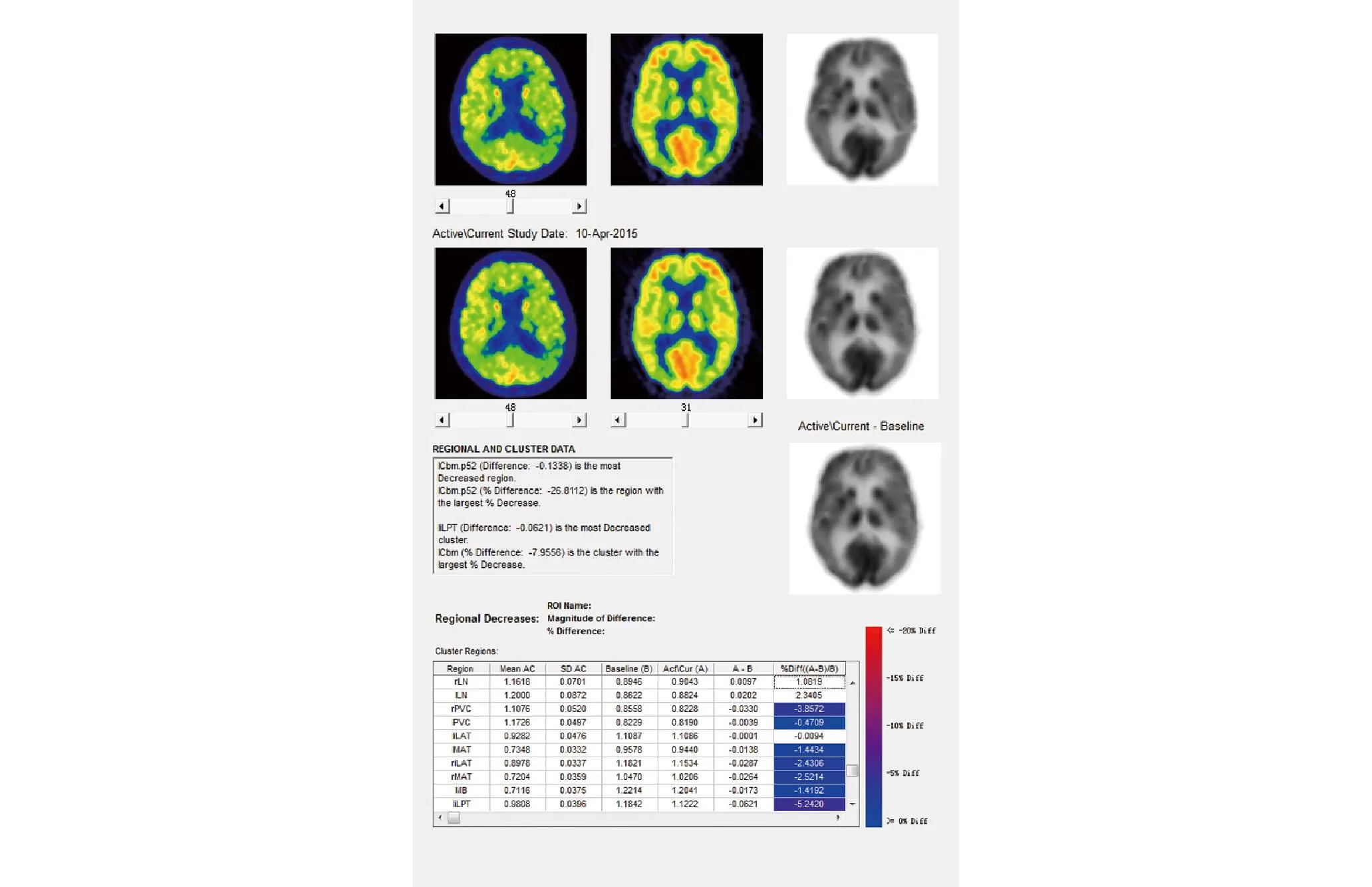 uMI 780 | Ultra-Fast High-Resolution Digital PET/CT - ΠΑΠΑΠΟΣΤΟΛΟΥ