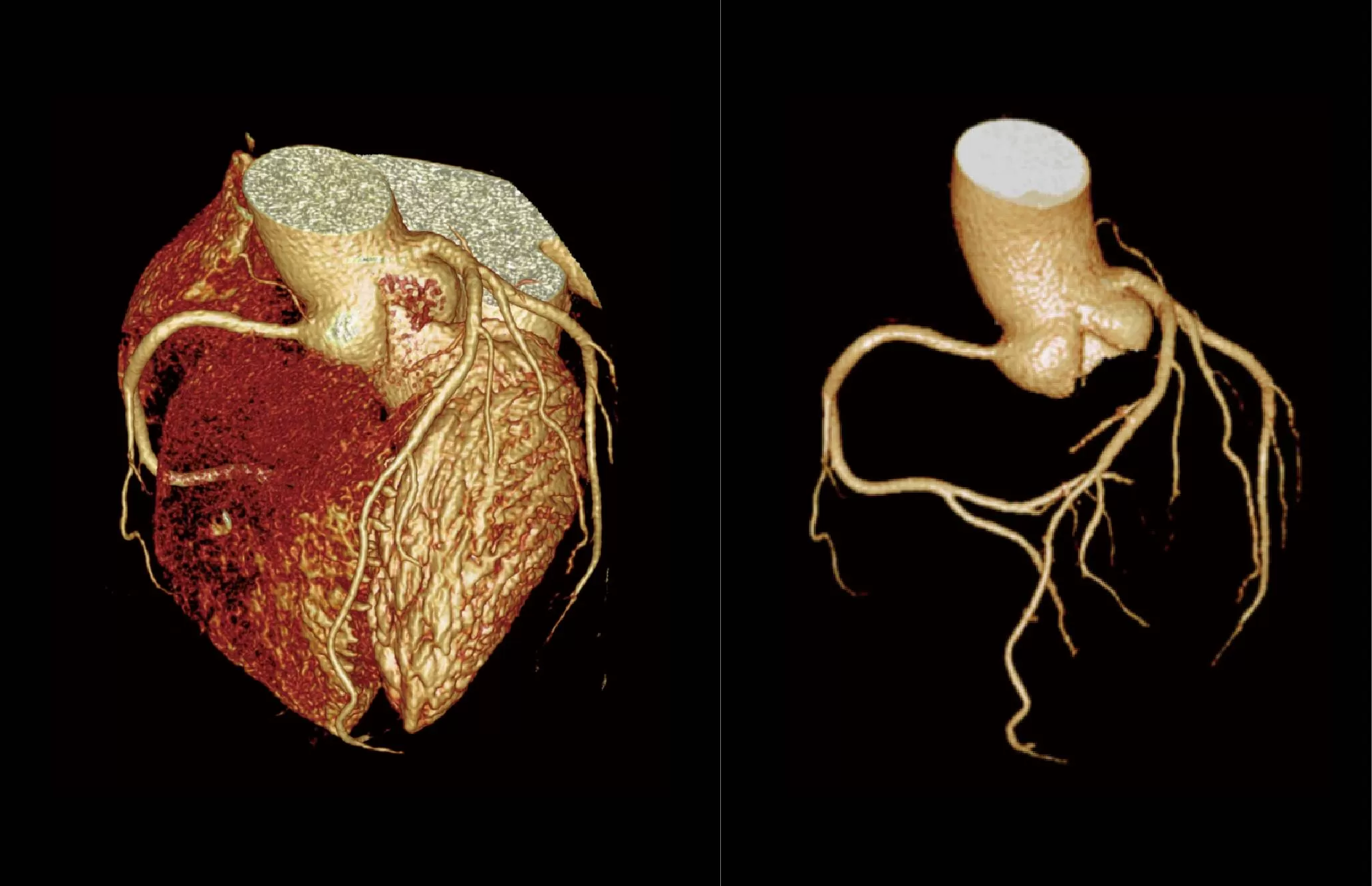 uMI 780 | Ultra-Fast High-Resolution Digital PET/CT - ΠΑΠΑΠΟΣΤΟΛΟΥ