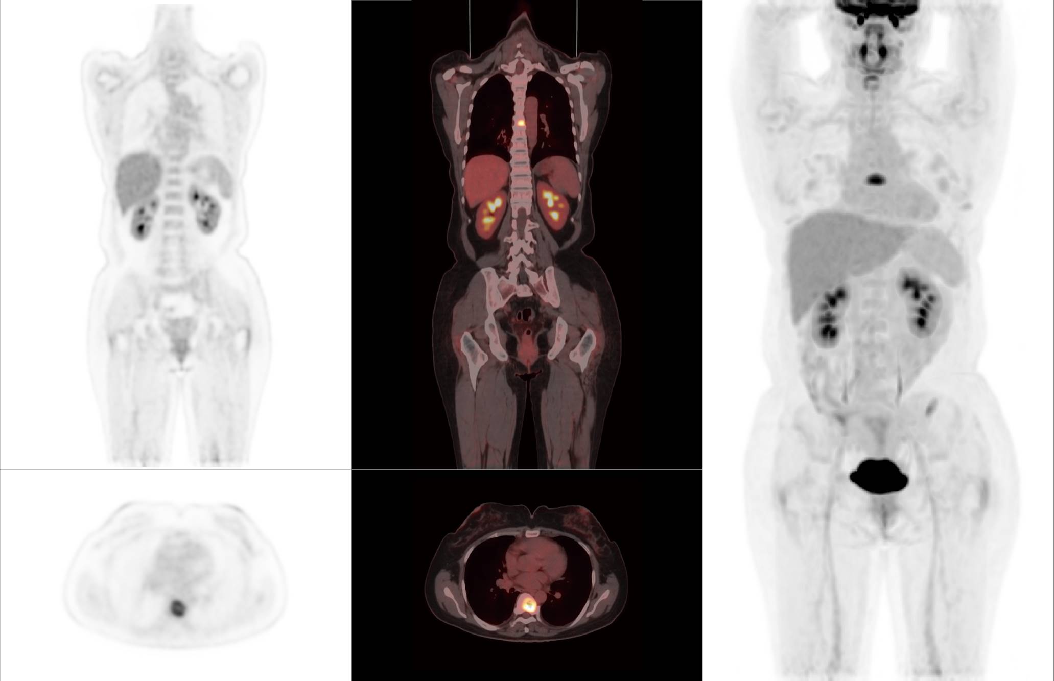 uMI 780 | Ultra-Fast High-Resolution Digital PET/CT - ΠΑΠΑΠΟΣΤΟΛΟΥ