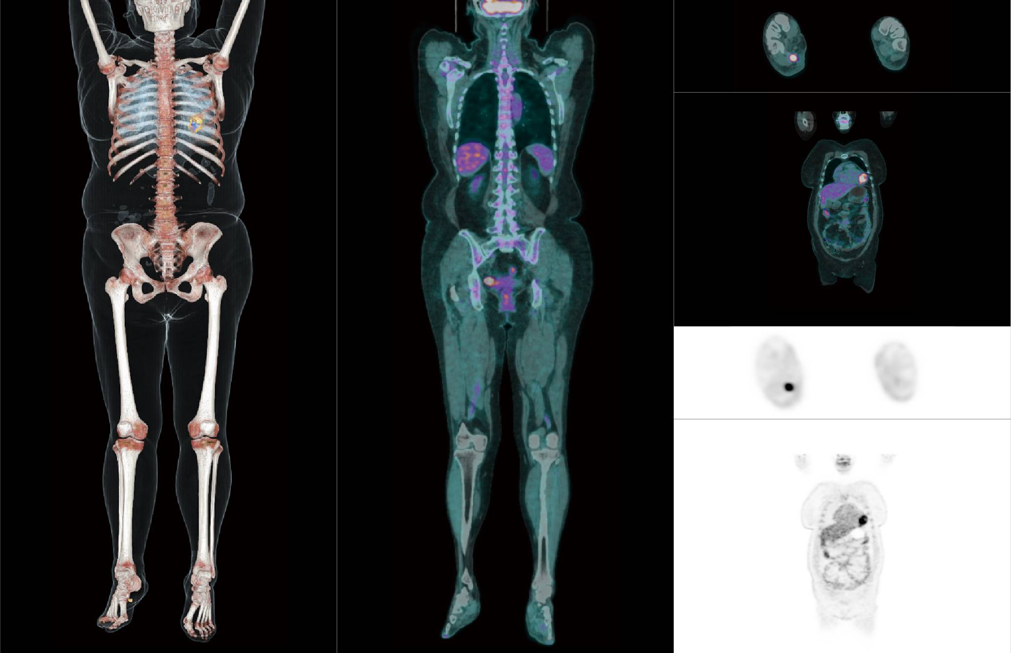 uMI 780 | Ultra-Fast High-Resolution Digital PET/CT - ΠΑΠΑΠΟΣΤΟΛΟΥ