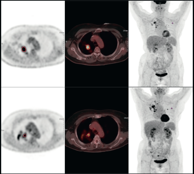 uMI 780 | Ultra-Fast High-Resolution Digital PET/CT - ΠΑΠΑΠΟΣΤΟΛΟΥ