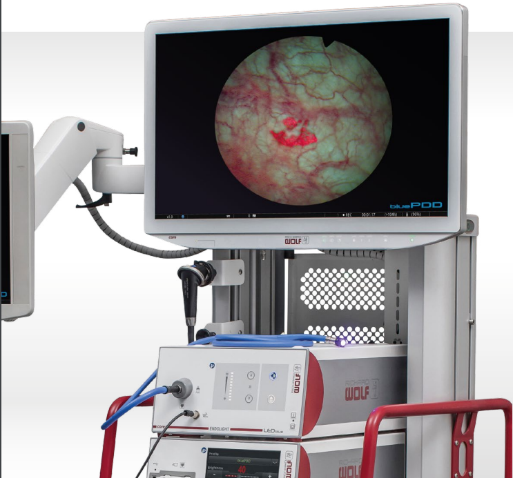 Σύστημα Φωτοδυναμικής Διάγνωσης (PDD), System Blue - ΠΑΠΑΠΟΣΤΟΛΟΥ