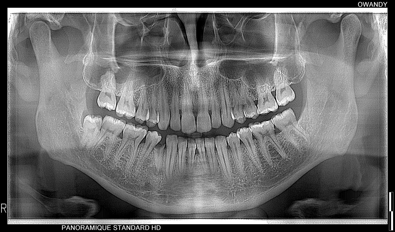 Πανοραμικό σύστημα CBCT I-MAX 3D PRO - ΠΑΠΑΠΟΣΤΟΛΟΥ